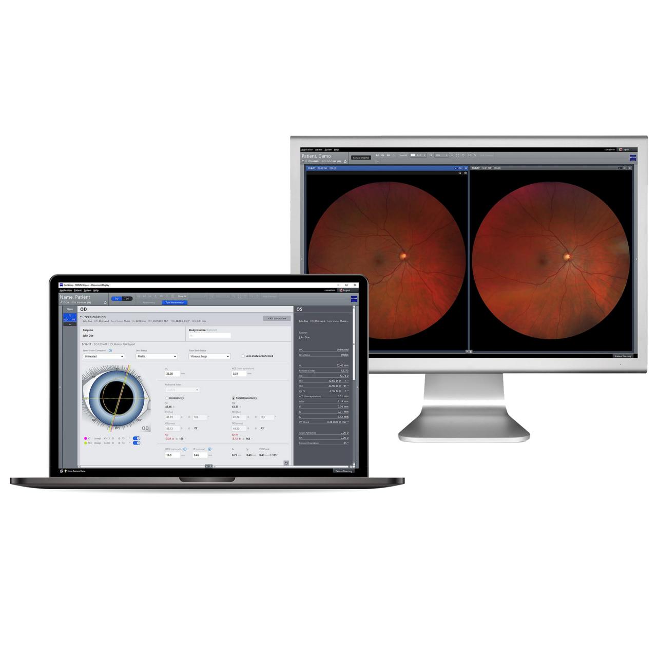 ZEISS Ophthalmology Data Management Systems