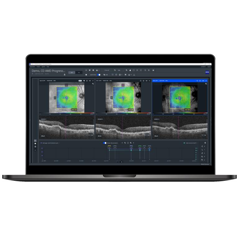 ZEISS Retina Workplace multimodality software