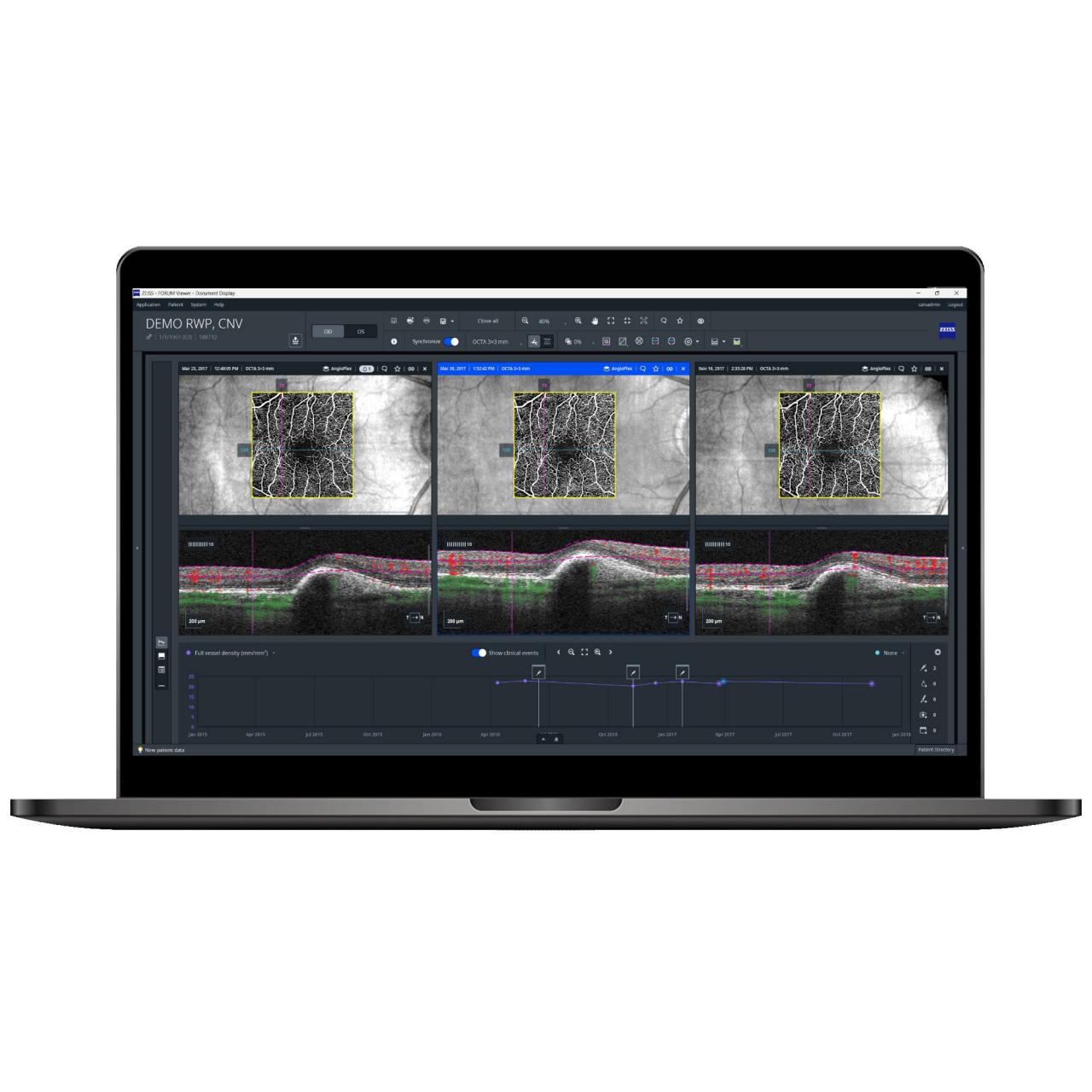 ZEISS Retina Workplace multimodality software