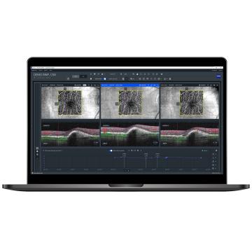 ZEISS Retina Workplace multimodality software