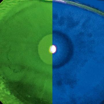 ZEISS SL 800 Slit lamp | ZEISS Medical Technology