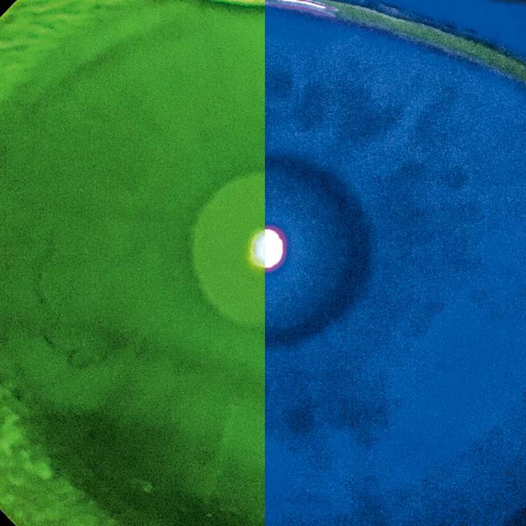 ZEISS SL 800 Slit lamp | ZEISS Medical Technology