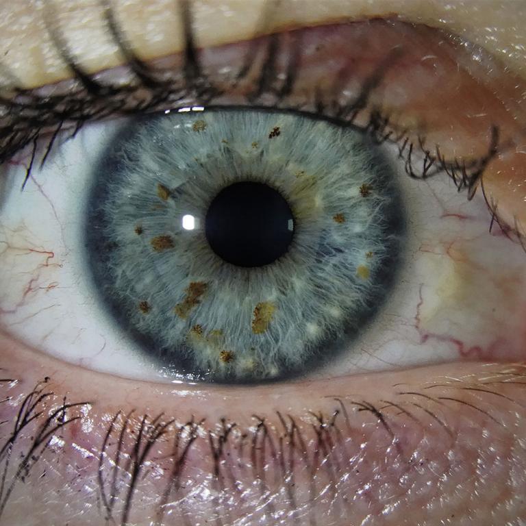 ZEISS SL 800 Slit lamp | ZEISS Medical Technology