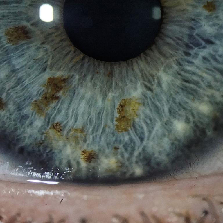 ZEISS SL 800 Slit lamp | ZEISS Medical Technology
