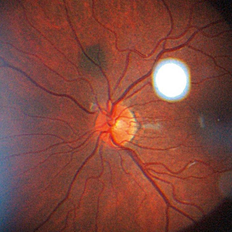 ZEISS SL 800 Slit lamp | ZEISS Medical Technology