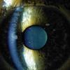 ZEISS SL 800 Slit lamp | ZEISS Medical Technology