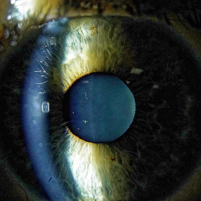 ZEISS SL 800 Slit lamp | ZEISS Medical Technology