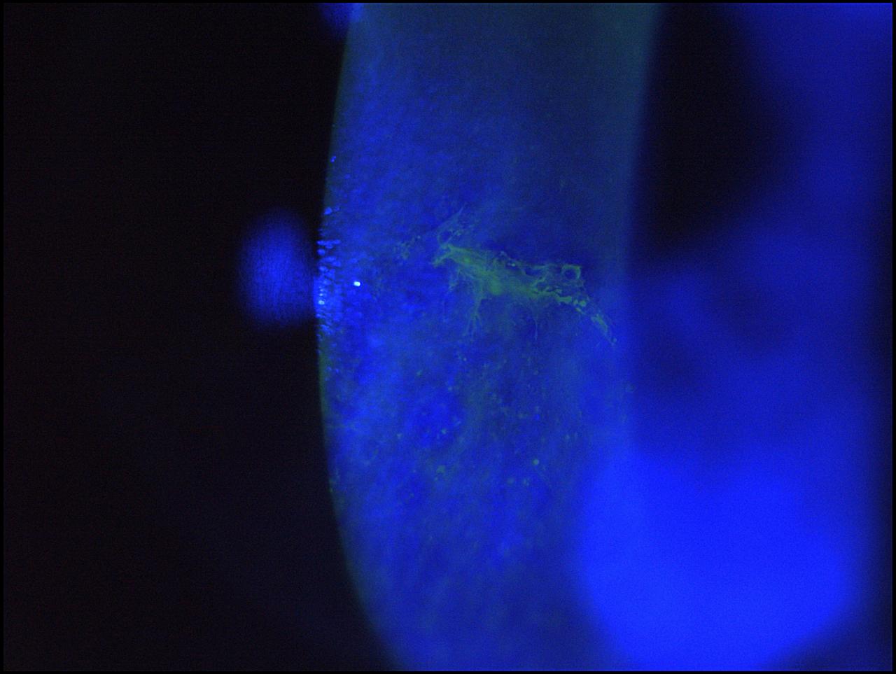 ZEISS SL Imaging Solution | ZEISS Medical Technology