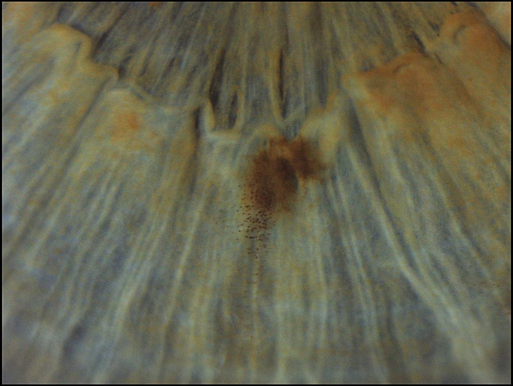 ZEISS SL Imaging Solution | ZEISS Medical Technology