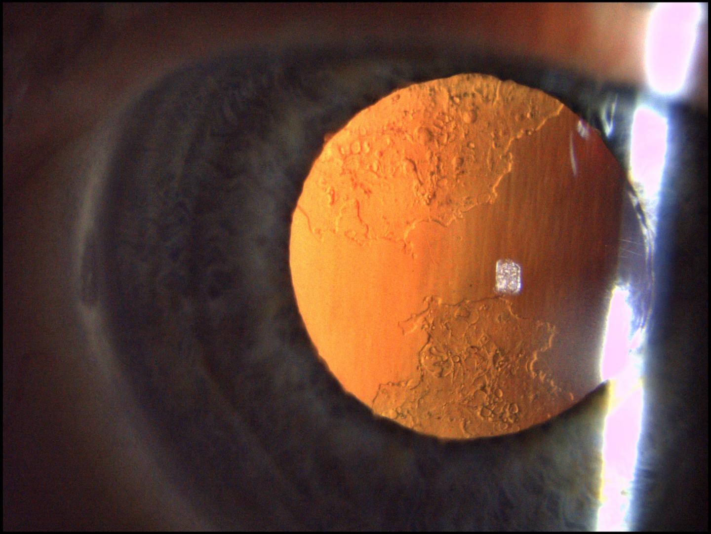 ZEISS SL Imaging Solution | ZEISS Medical Technology