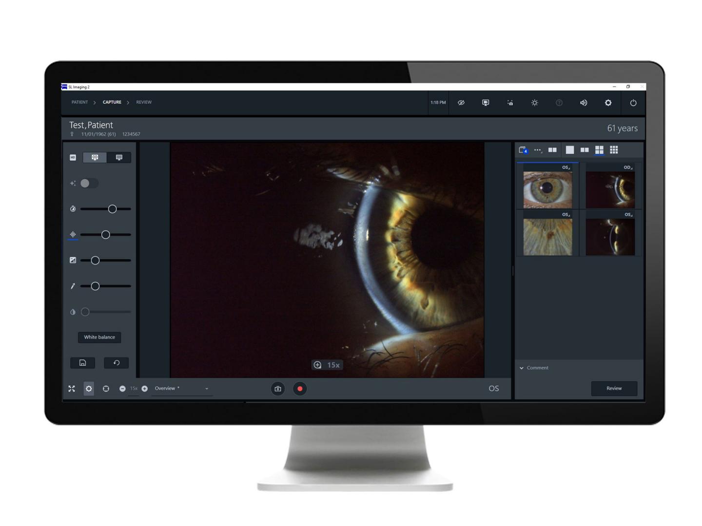 ZEISS SL Imaging Solution | ZEISS Medical Technology