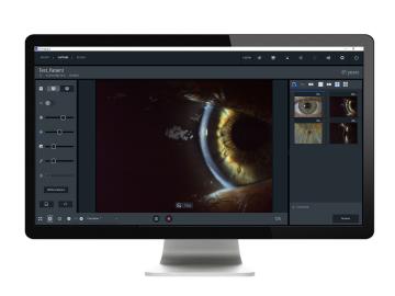 ZEISS SL Imaging Solution | ZEISS Medical Technology