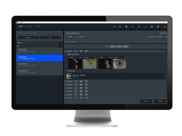 ZEISS SL Imaging Solution | ZEISS Medical Technology