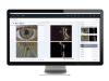ZEISS SL Imaging Solution | ZEISS Medical Technology