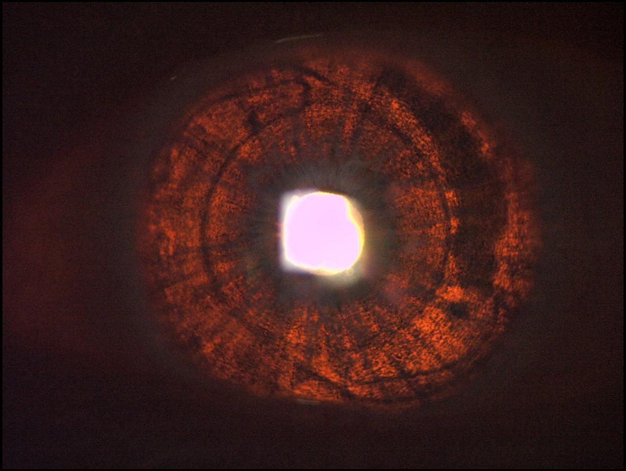 ZEISS SL Imaging Solution | ZEISS Medical Technology