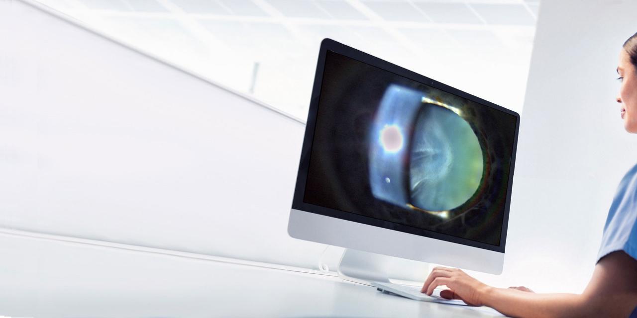 ZEISS SL Imaging Solution | ZEISS Medical Technology