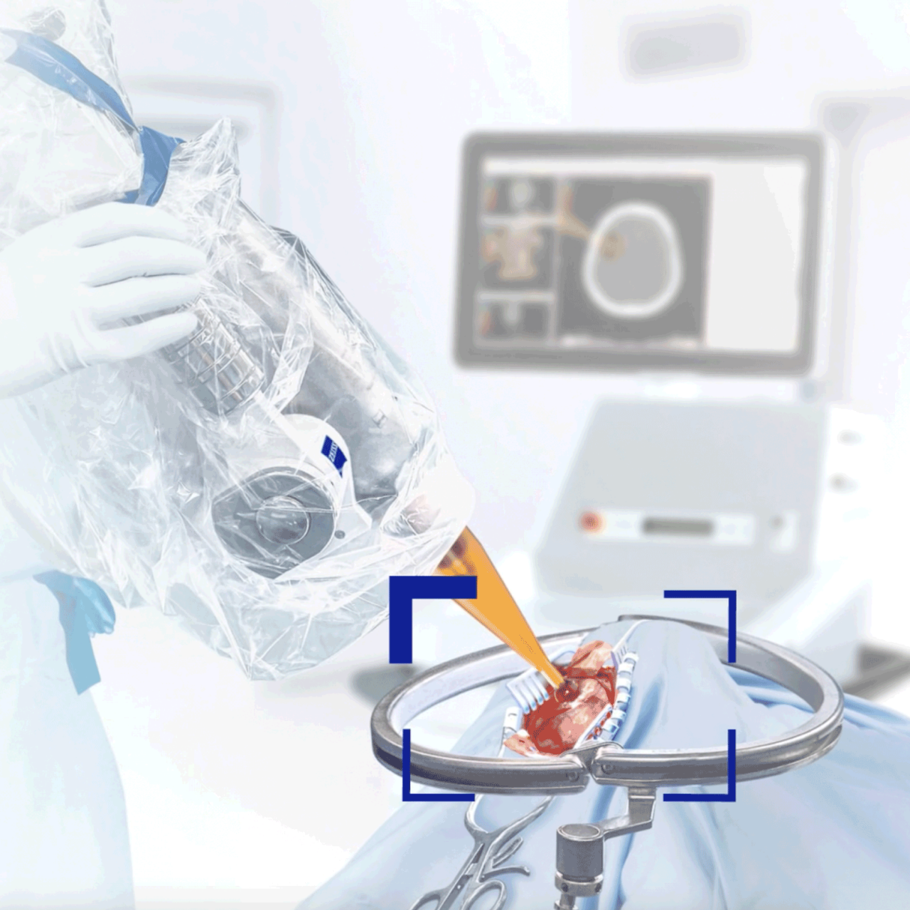 Sistemas de radioterapia intraoperatoria de ZEISS