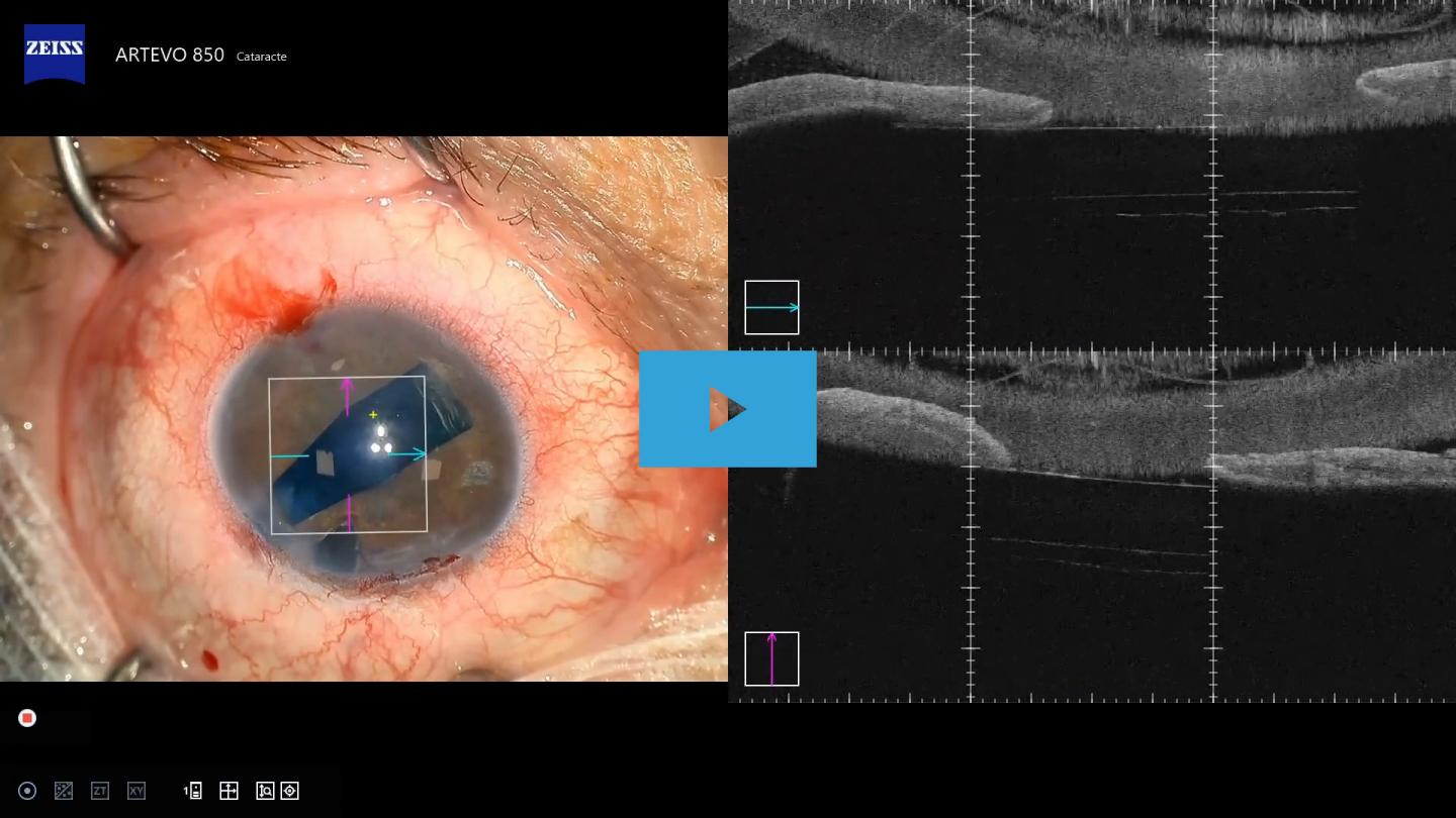 ZEISS ARTEVO 850 | ZEISS Medical Technology