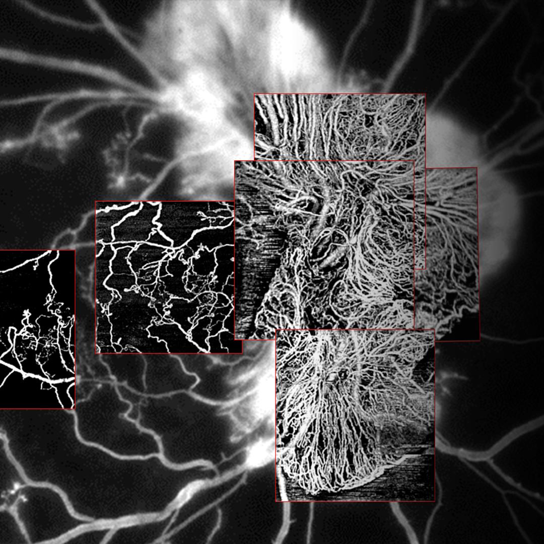 ZEISS Cirrus 6000 AngioPlex OCT Angiography | ZEISS Medical Technology