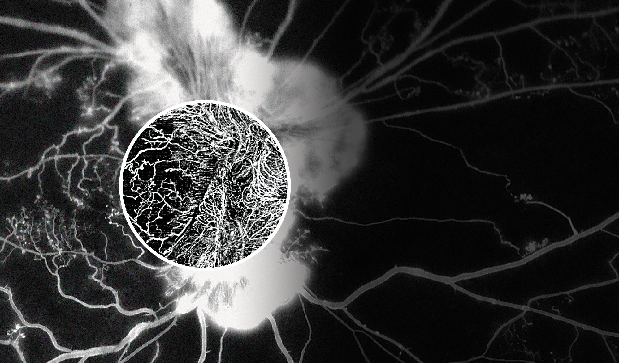 ZEISS Cirrus 6000 AngioPlex OCT Angiography | ZEISS Medical Technology