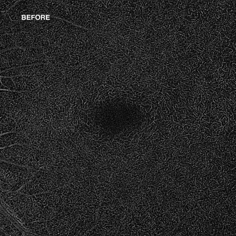 CIRRUS 6000, OCT Imaging, 100 kHz OCT system