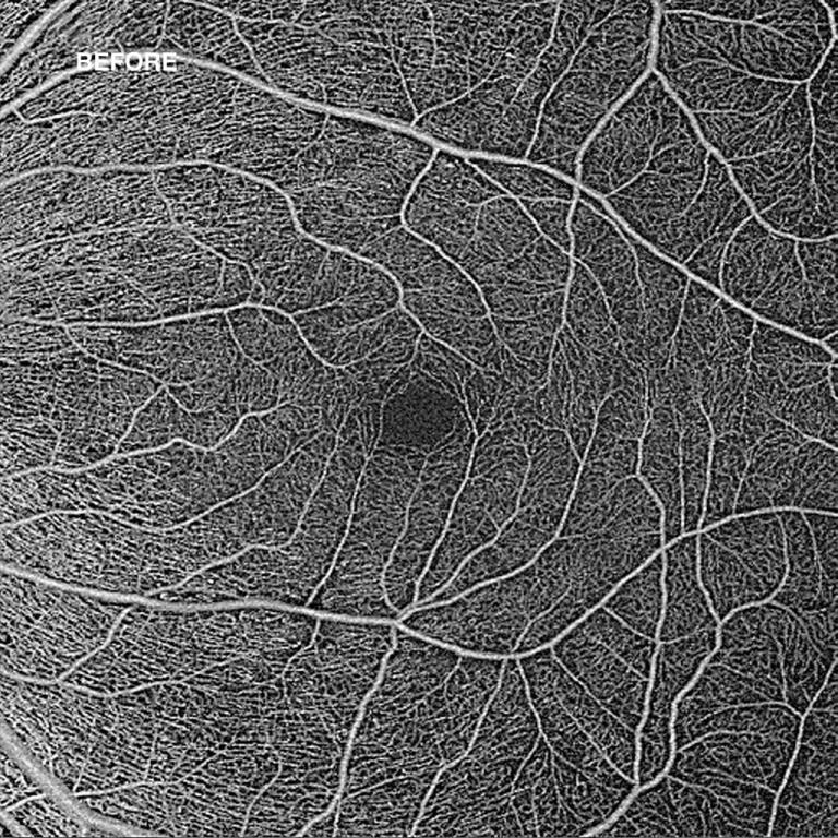 CIRRUS 6000, OCT Imaging, 100 kHz OCT system