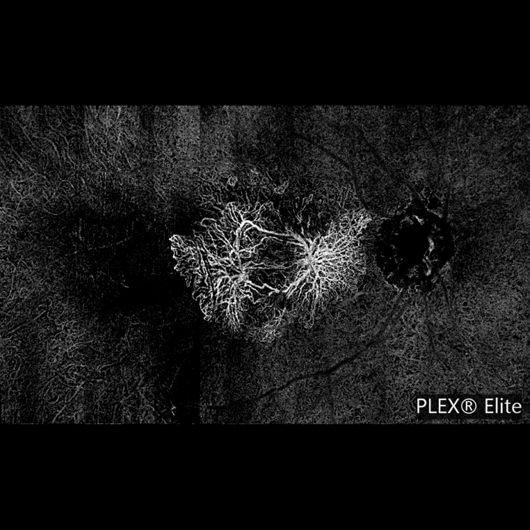 ZEISS PLEX Elite 9000 - Swept-Source OCT Angiography