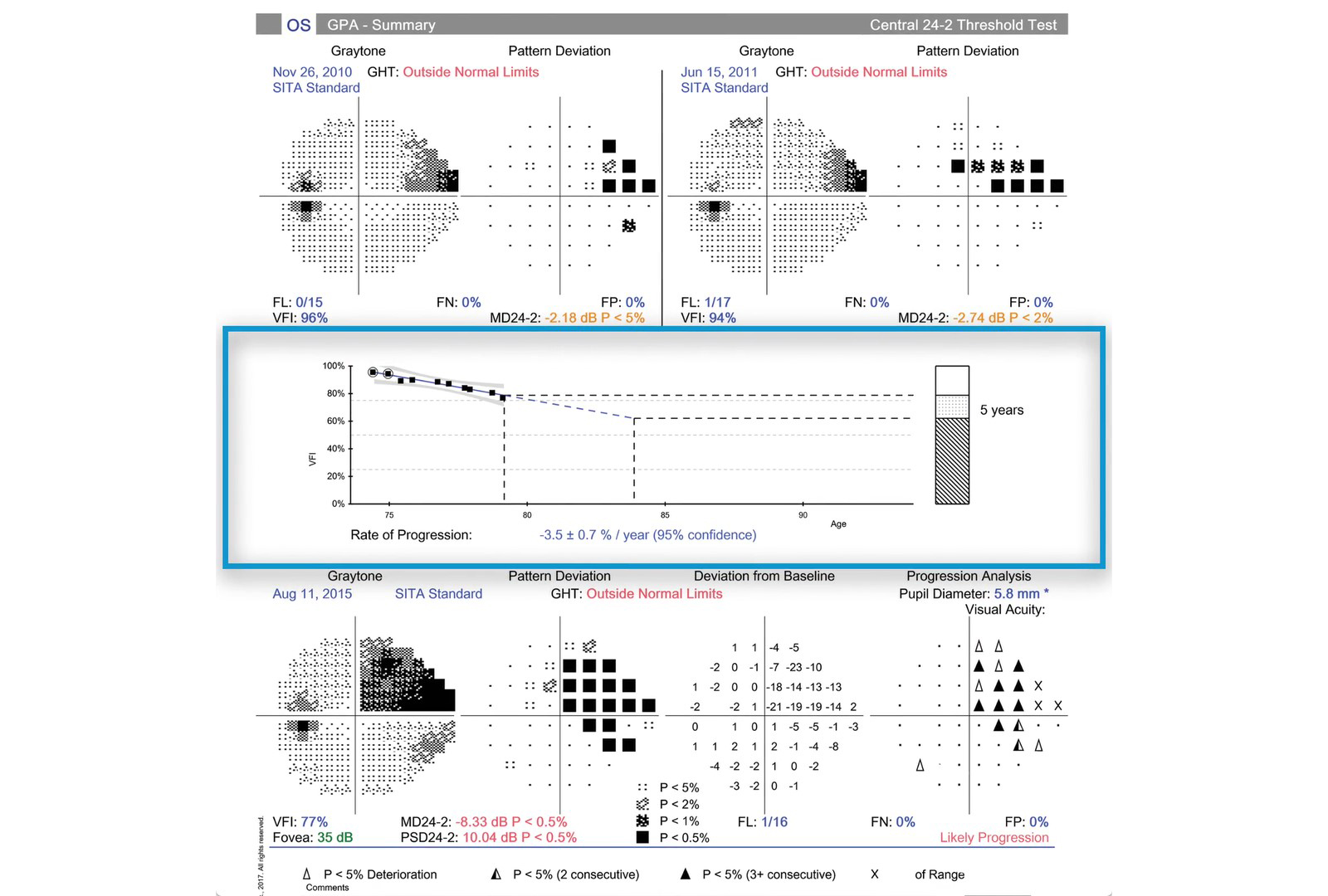 Humphrey Field Analyzer 3 | ZEISS Medical Technology