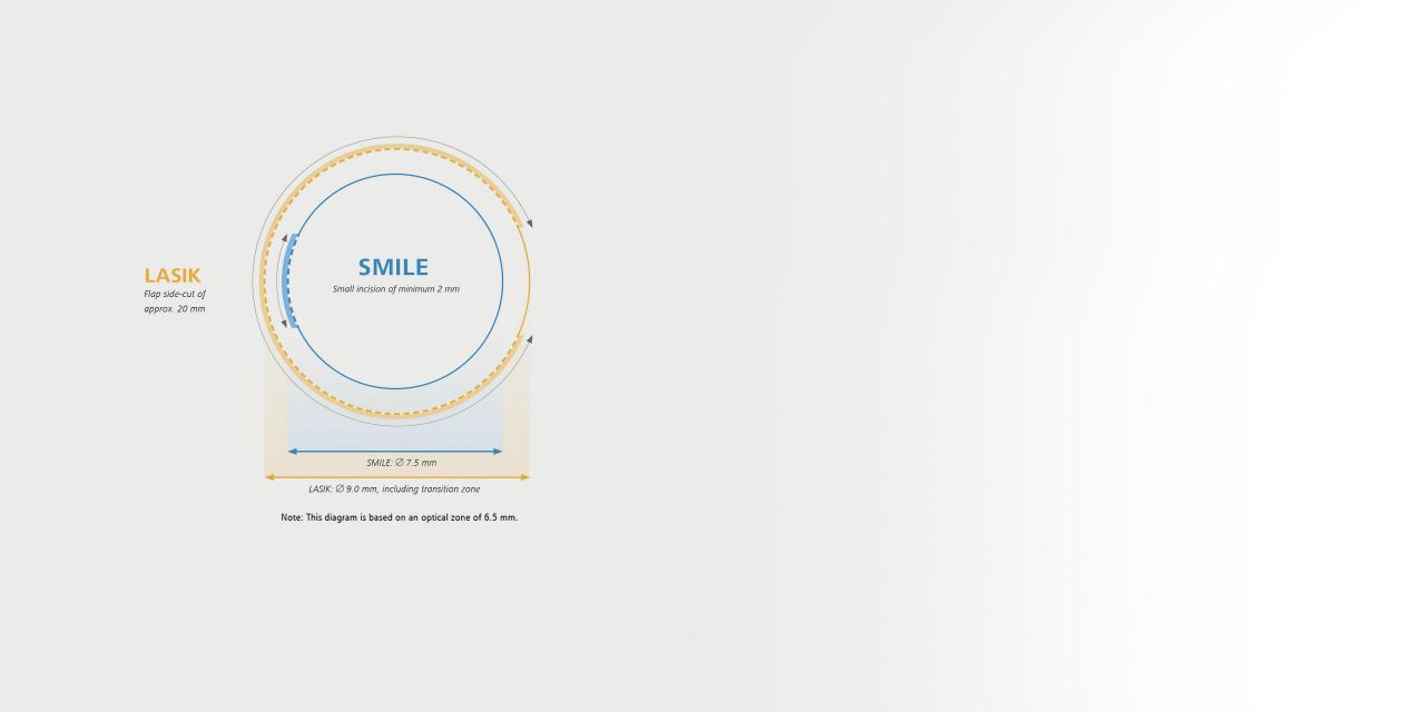 ZEISS SMILE – Femtosecond Laser Solutions