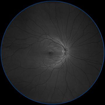ZEISS CLARUS 500 Fundus Camera