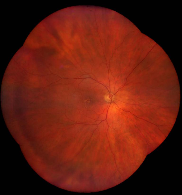 ZEISS CLARUS 500 Funduskamera