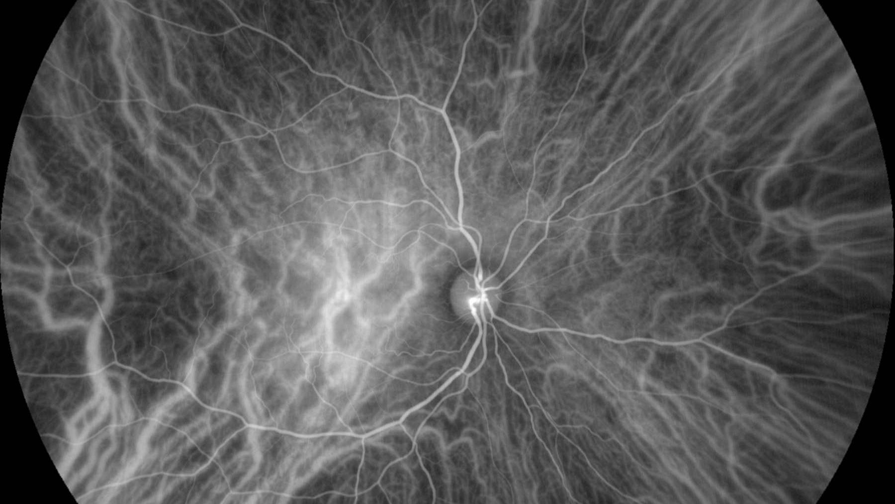 ZEISS CLARUS 700 | ZEISS Medical Technology