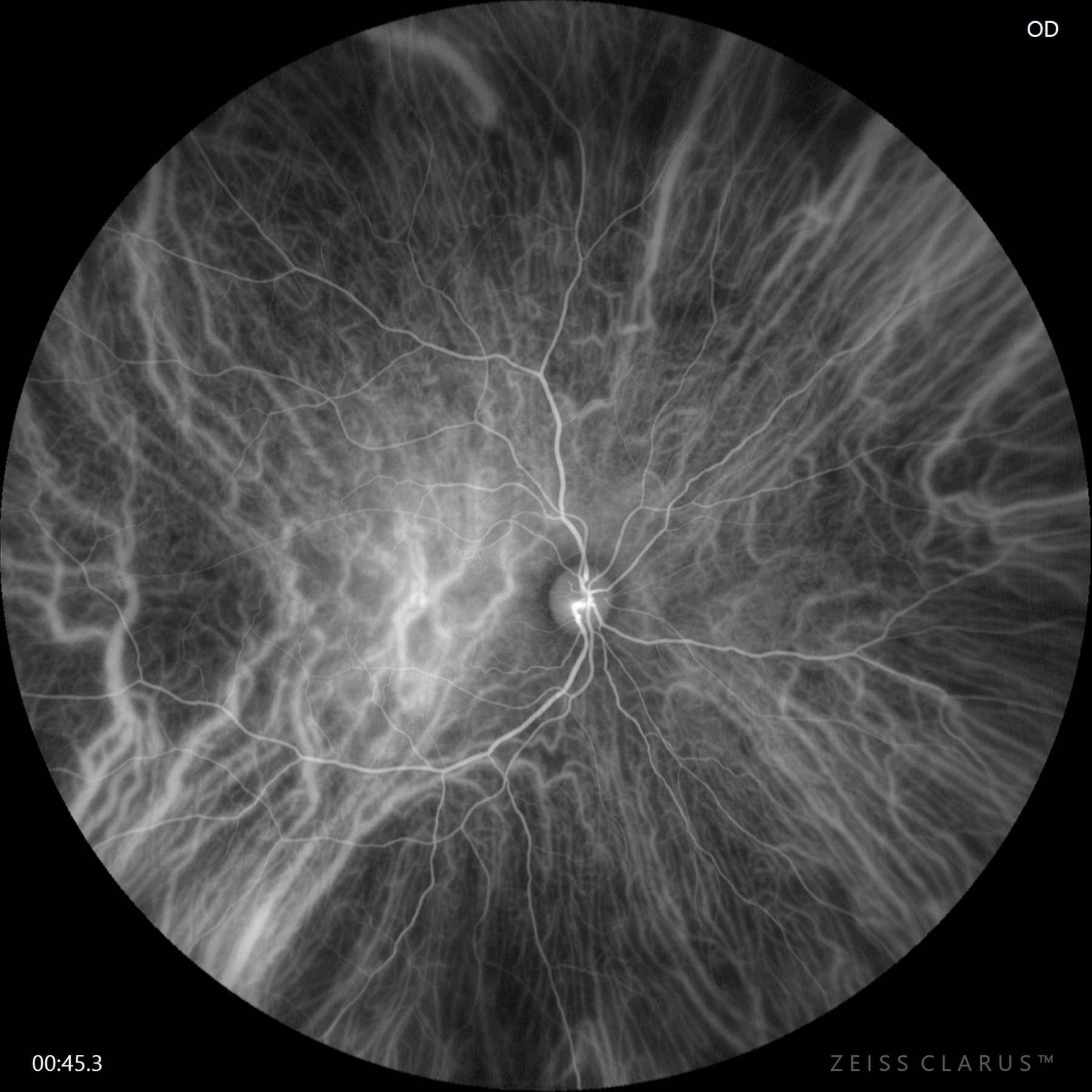 ZEISS CLARUS 700 | ZEISS Medical Technology