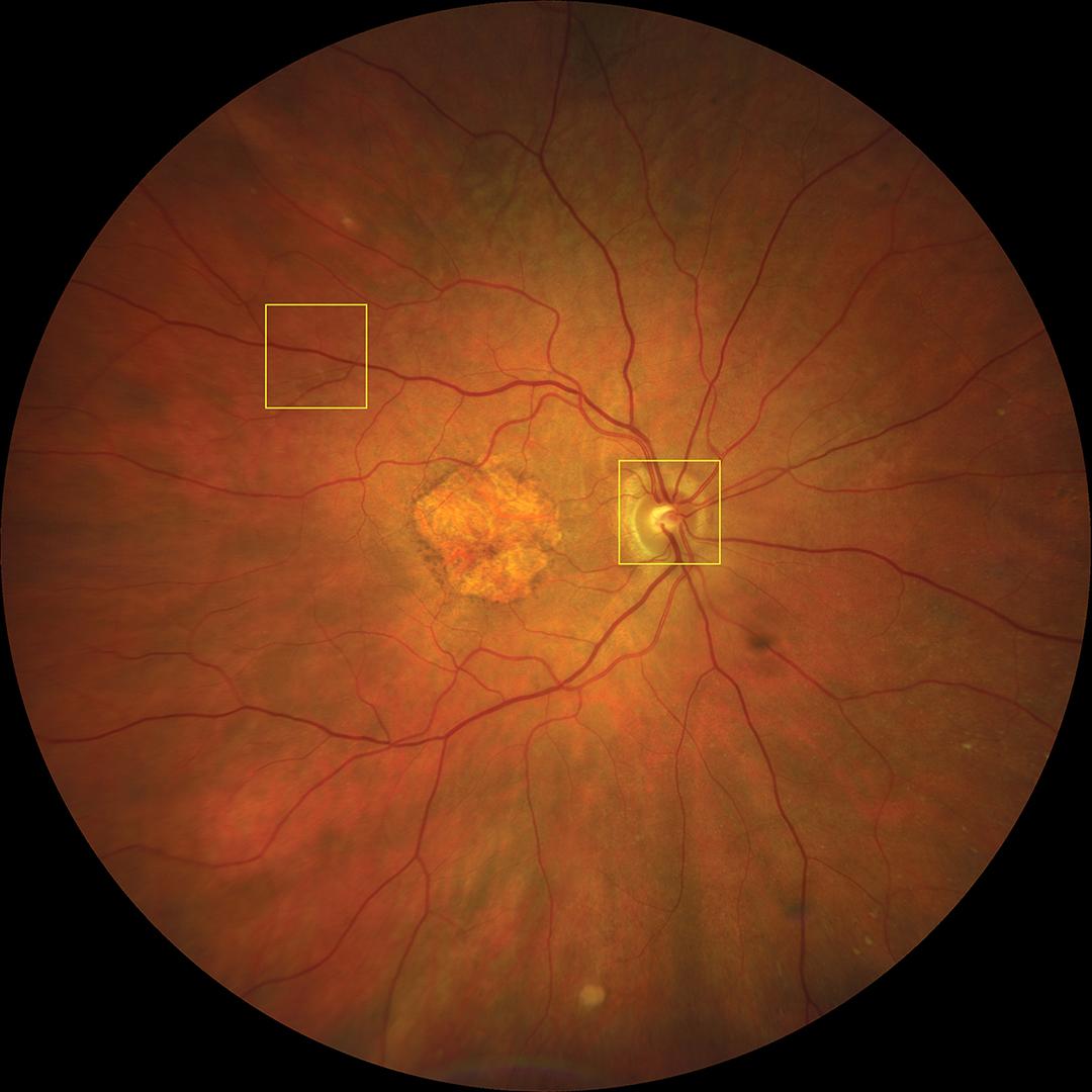ZEISS CLARUS 700 | ZEISS Medical Technology