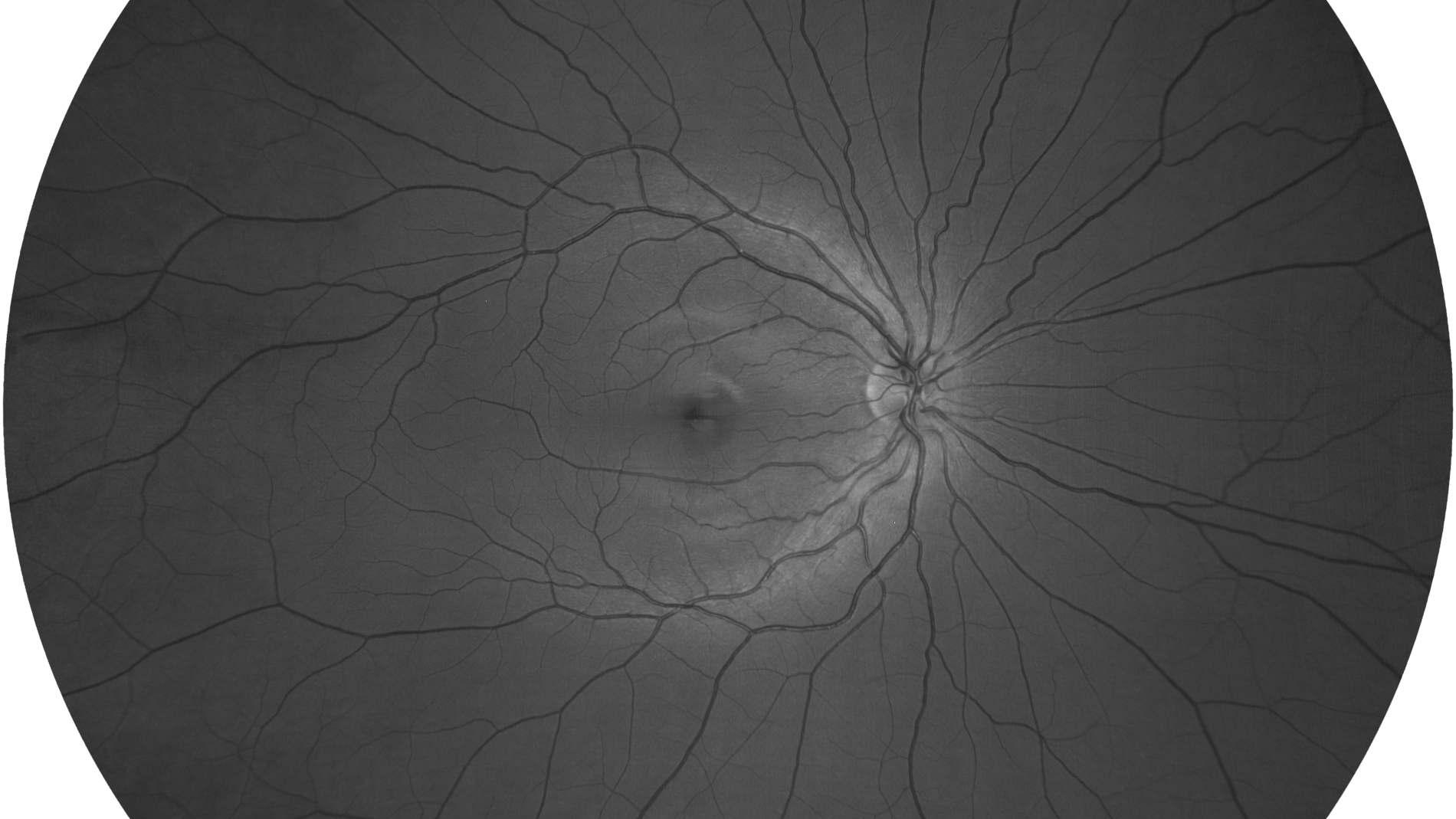 ZEISS CLARUS 700 | ZEISS Medical Technology