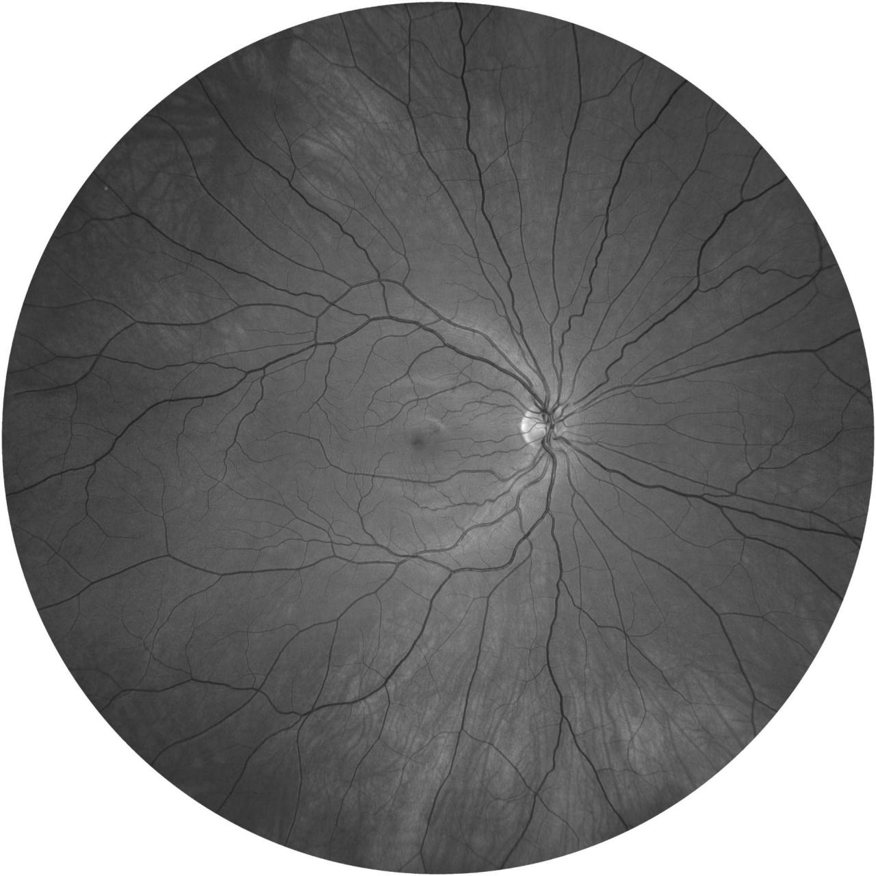 ZEISS CLARUS 700 | ZEISS Medical Technology
