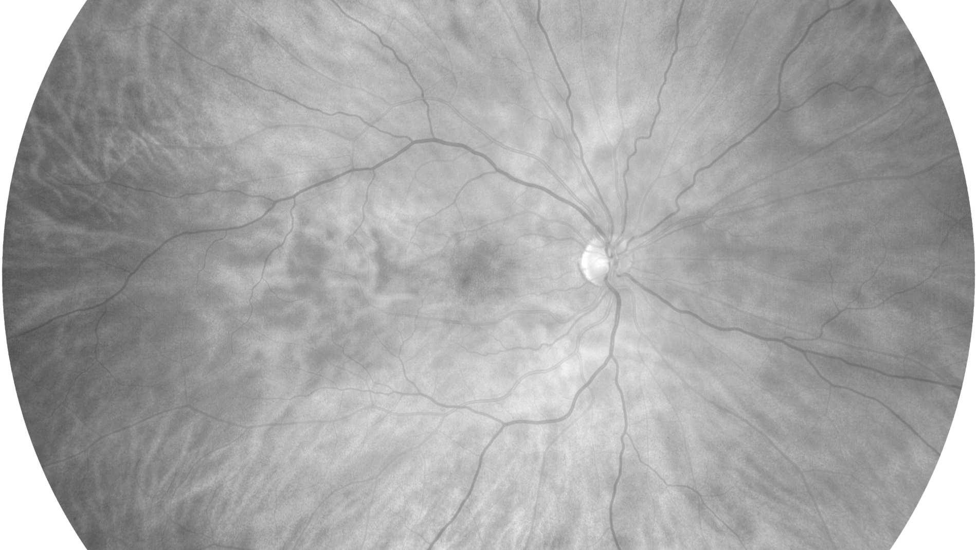ZEISS CLARUS 700 | ZEISS Medical Technology