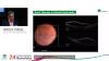 ZEISS ARTEVO 850 Retina | ZEISS Medical Technology