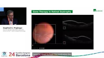 ZEISS ARTEVO 850 Retina | ZEISS Medical Technology