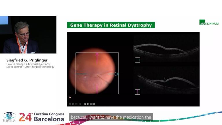ZEISS ARTEVO 850 Retina | ZEISS Medical Technology