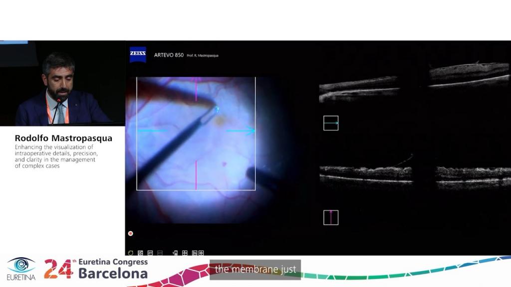 ZEISS ARTEVO 850 Retina | ZEISS Medical Technology