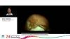 ZEISS ARTEVO 850 Retina | ZEISS Medical Technology