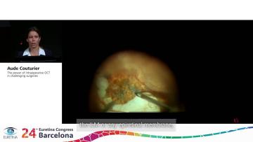 ZEISS ARTEVO 850 Retina | ZEISS Medical Technology