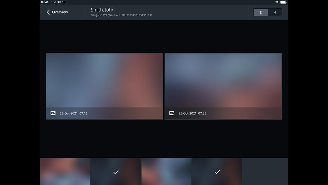 Microscópio operatório ZEISS EXTARO 300 ENT