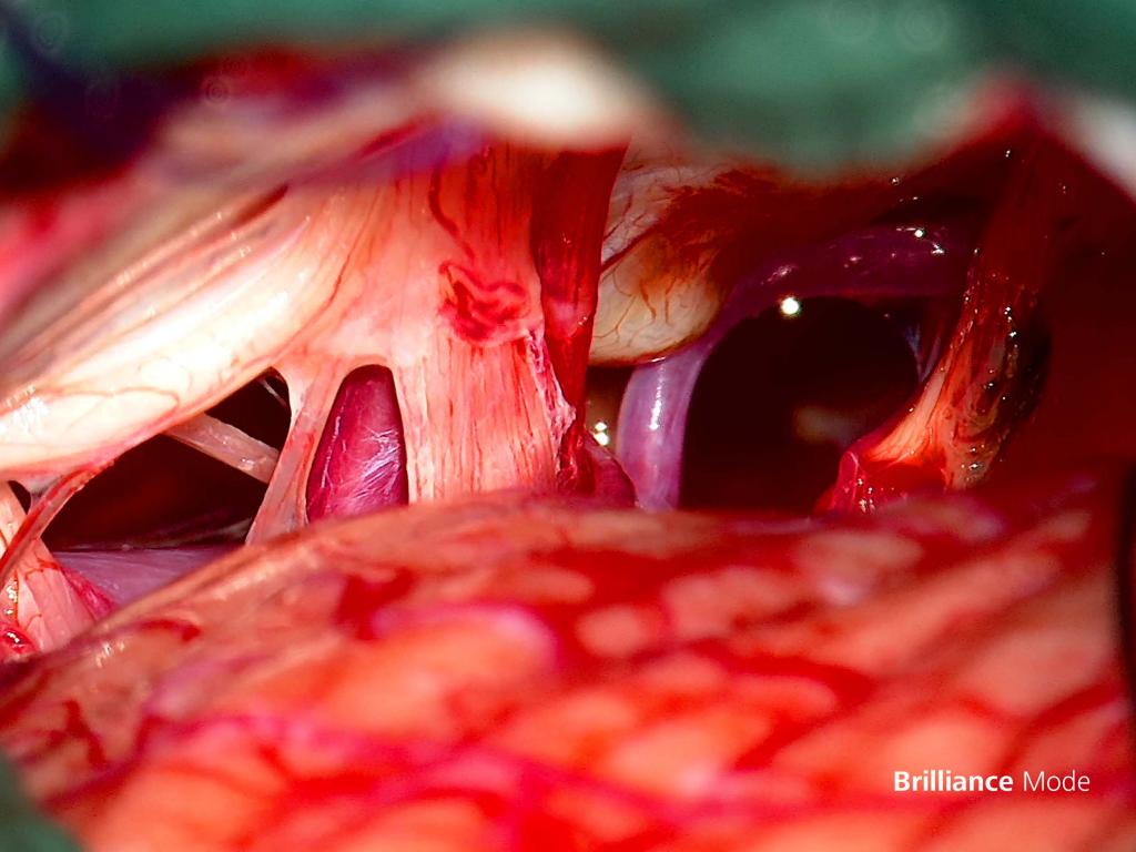 ZEISS KINEVO 900 S | Surgical Microscopes