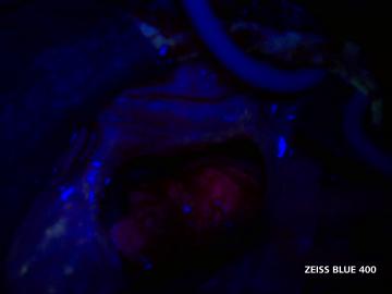 ZEISS KINEVO 900 S | Surgical Microscopes