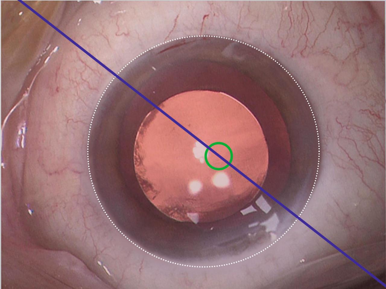 ZEISS CALLISTO eye | ZEISS Medical Technology