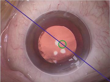 ZEISS CALLISTO eye | ZEISS Medical Technology