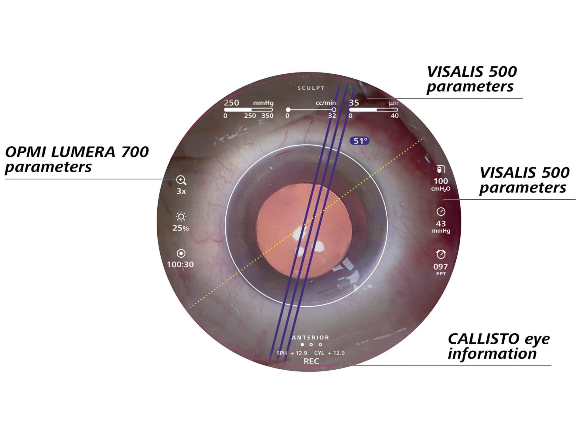 Microscopio oftálmico ZEISS OPMI LUMERA 700
