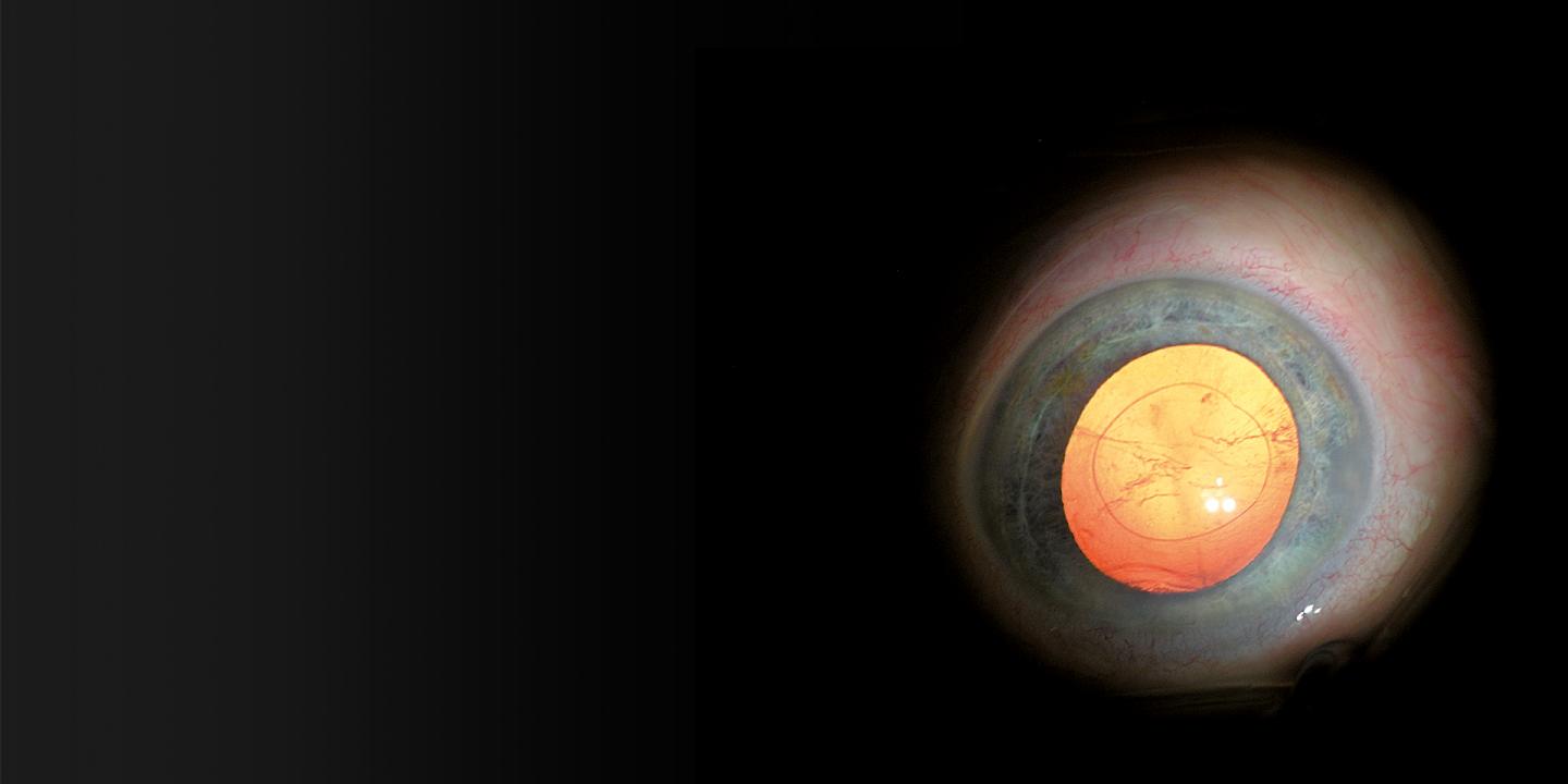 ZEISS OPMI Lumera i | ZEISS Medical Technology